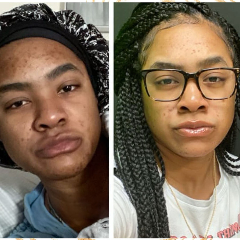 Skin Stories Unveiled – Pretty Biznez